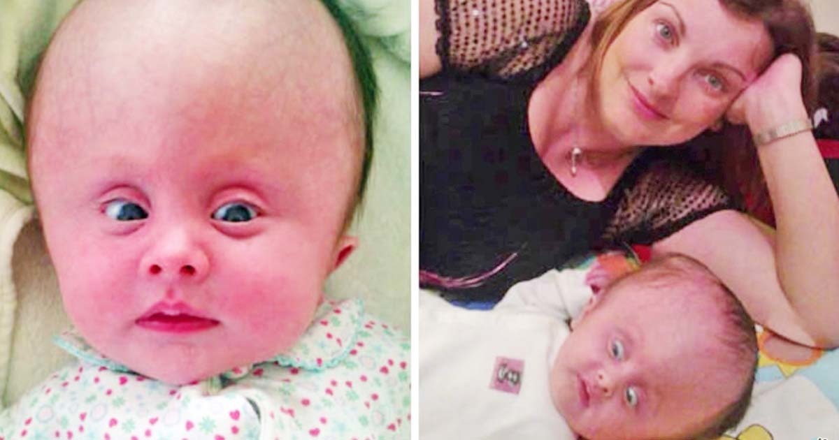 Lydia survived against all odds - now the 4-year-old is charming ...