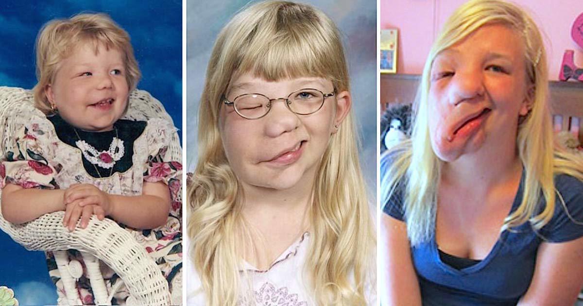 Doctors refused to touch Sarah's face - so she took matters into her ...